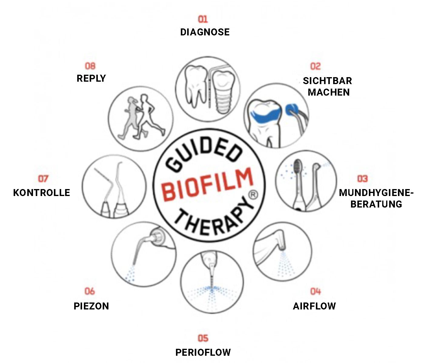 Biofilm - Zahnklinik Globe Dental Ungarn